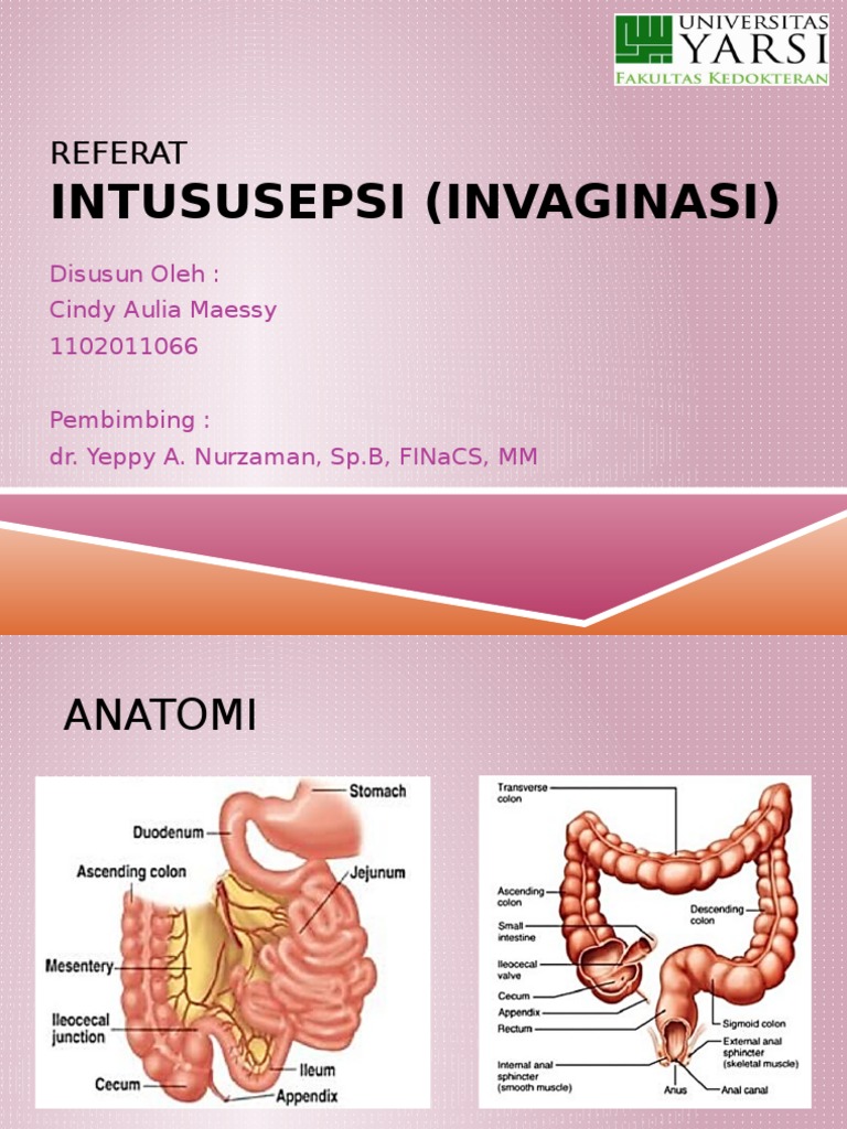 Referat Intususepsi | PDF | Pengembangan Diri | Kesehatan Holistik