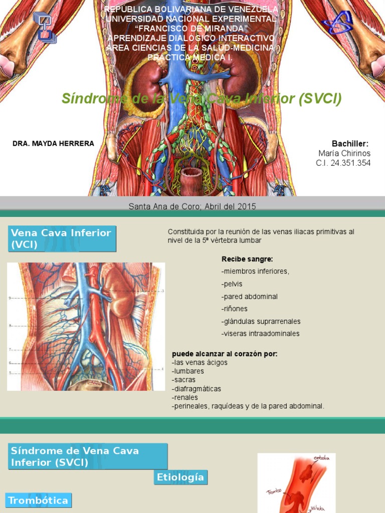 Sindrome Vena Cava Inferior | PDF | Trombo | Abdomen Sindrome Vena Cava Inferior | PDF | Trombo | Abdomen