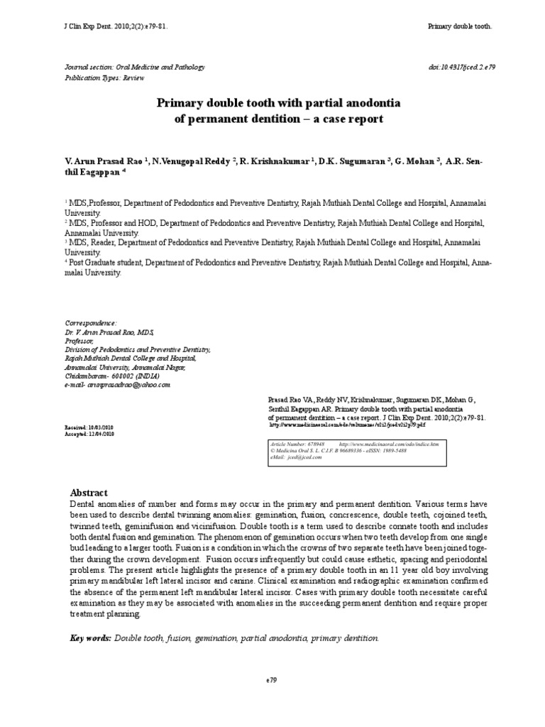 Primary Double Tooth With Partial Anodontia of Permanent Dentition - A ...
