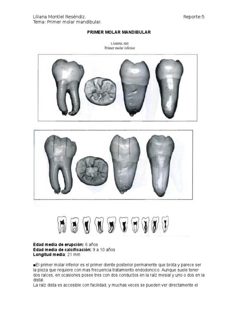 Primer Molar Mandibular | Descargar gratis PDF | Geometría | Boca