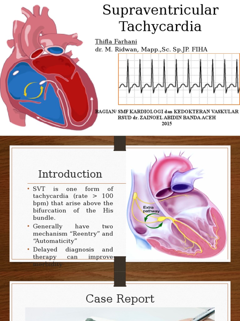 Supraventricular Tachycardia Overview | PDF | Cardiac Arrhythmia ...
