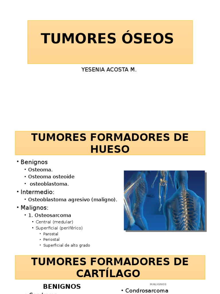 Tumores Óseos y Cartilaginosos | PDF | Hueso | Cáncer