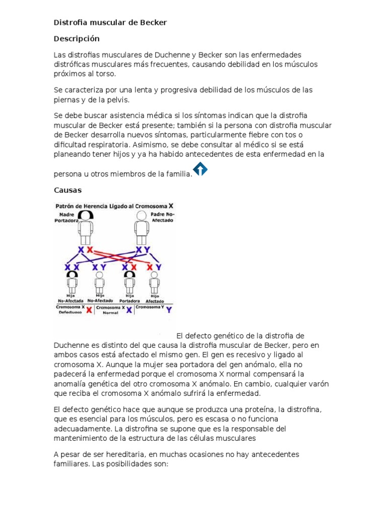 Distrofia Muscular de Becker