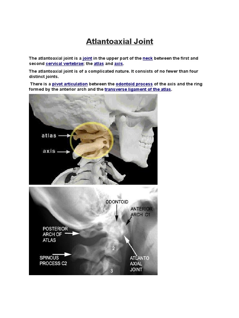 Atlantoaxial Joint | PDF | Human Anatomy | Joints