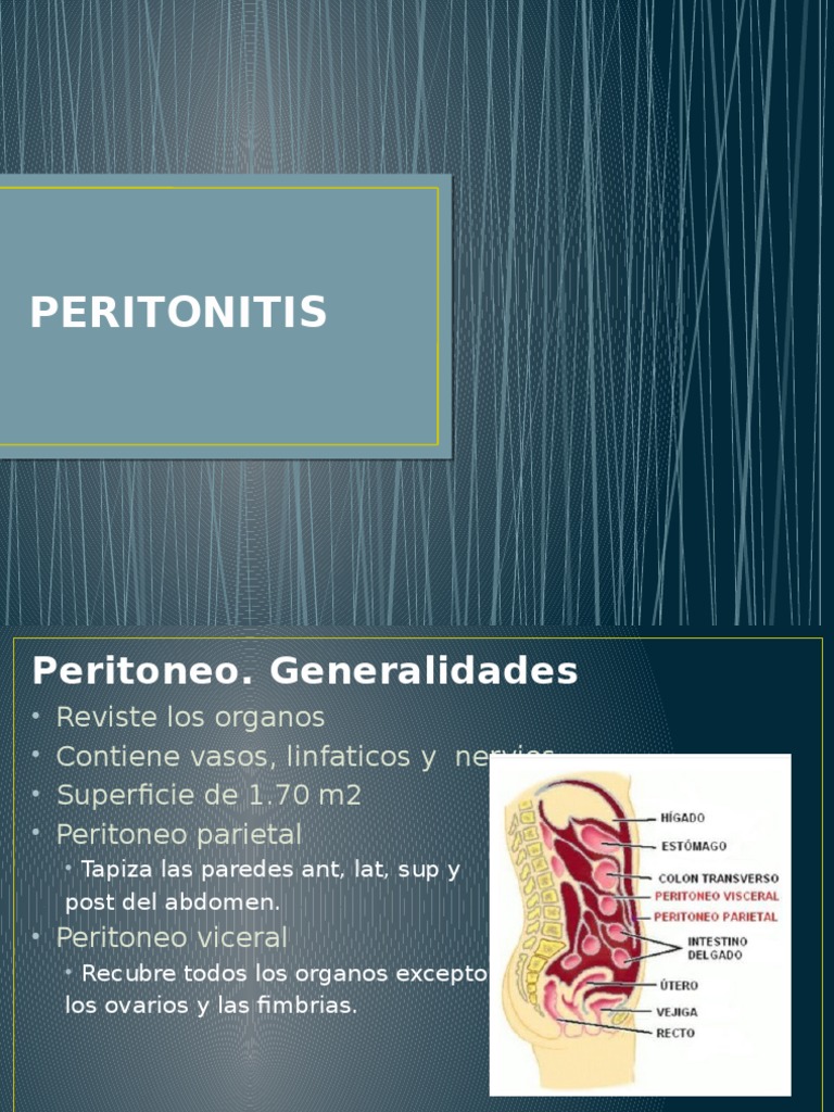 Peritonitis Aguda | PDF | Abdomen | Septicemia