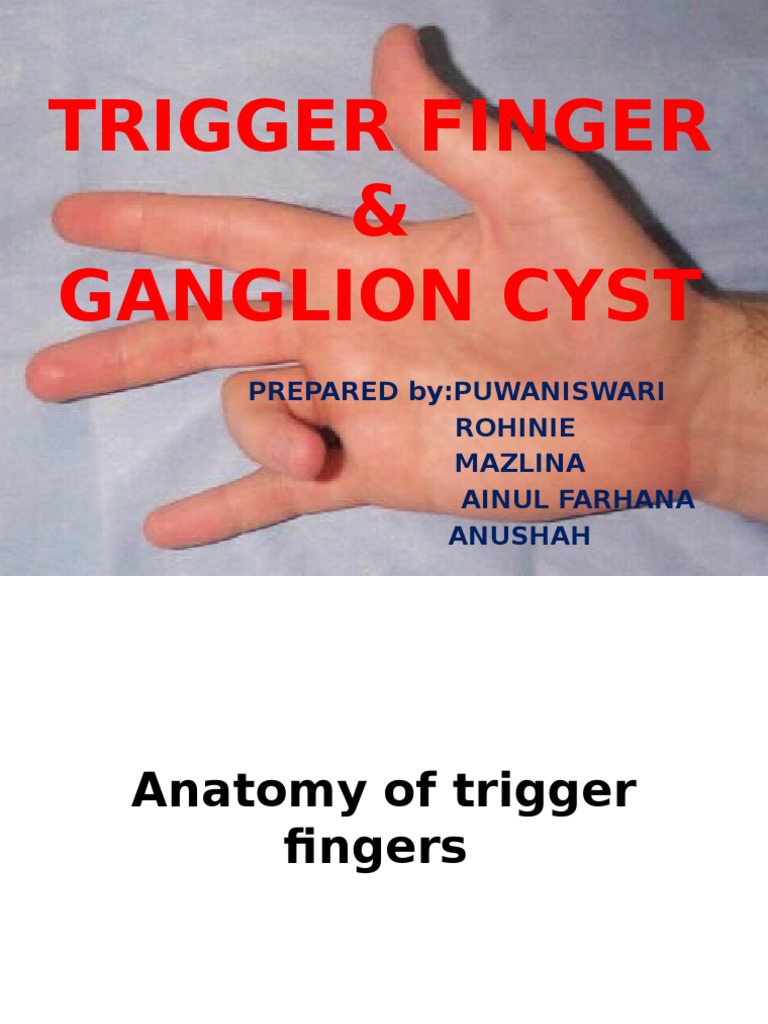 Trigger Finger and Ganglion Cysts Overview | PDF | Finger ...