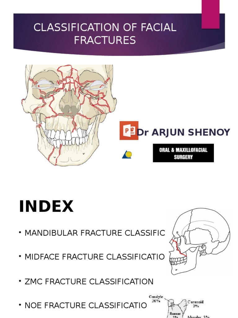facial fractures classification | Skeletal System | Musculoskeletal System