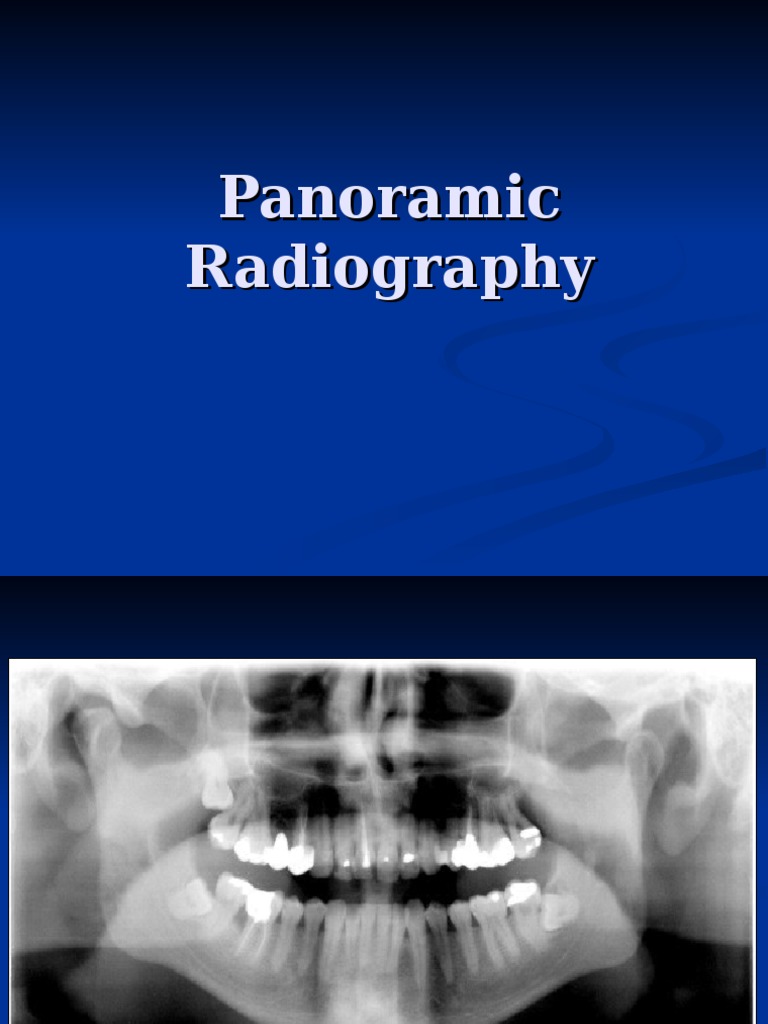 Panorama | Radiography | Rotation