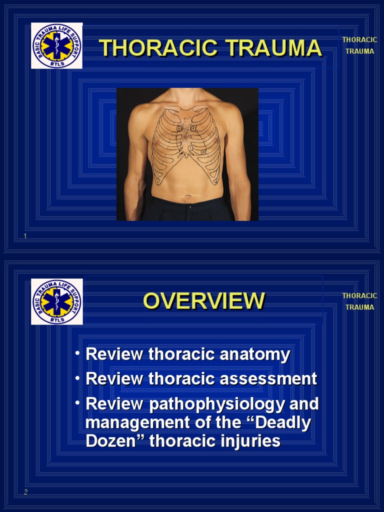 06 Thoracic Trauma | PDF | Thorax | Major Trauma