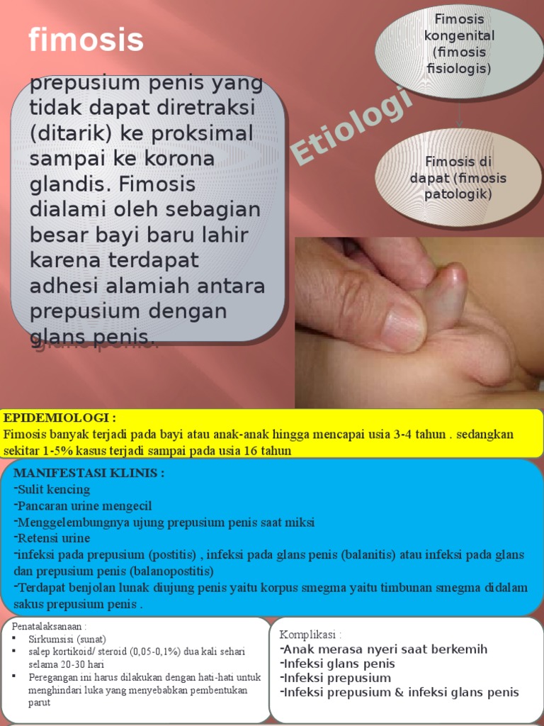 Fimosis | PDF | Sains & Matematika