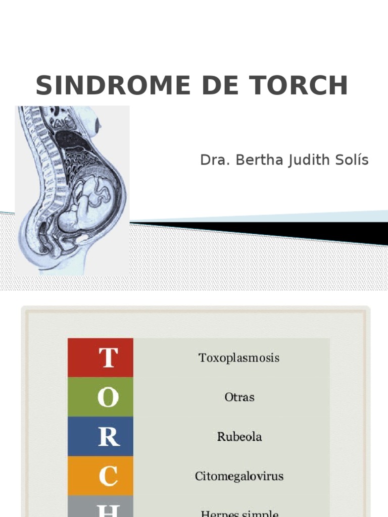 SINDROME DE TORCH.pptx | Virus | Herpes Simple