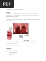Fisiopatología de La Faringitis | PDF | Epidemiología | Microbiología
