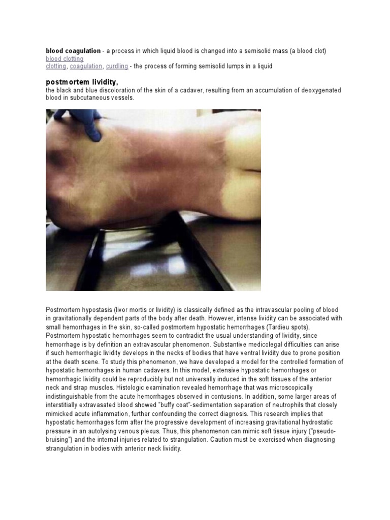 Postmortem Lividity,: Blood Clotting Clotting Coagulation Curdling | PDF
