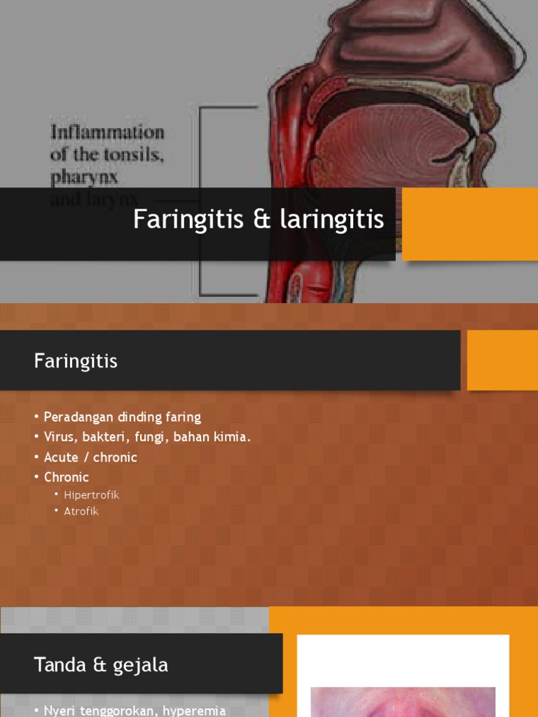 Faringitis & Laringitis | PDF
