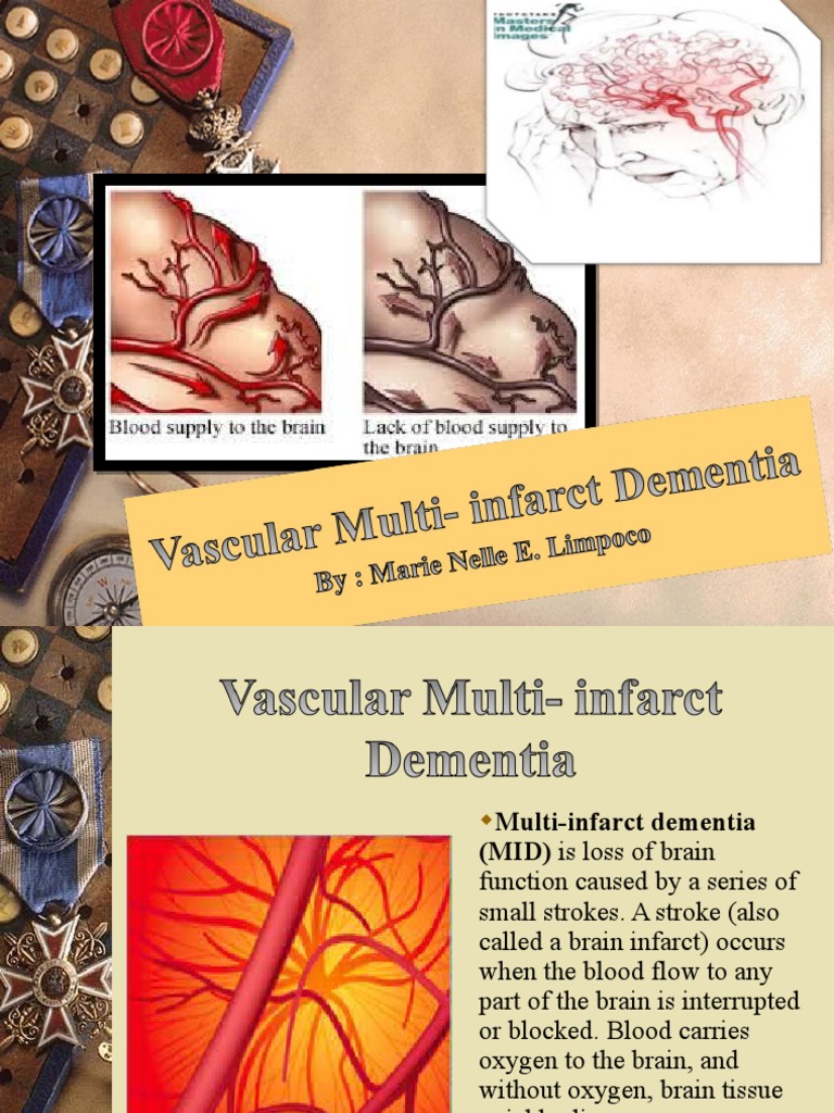 MUlti Infarct Dementia | Dementia | Blood Vessel