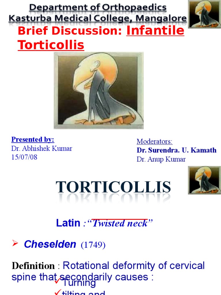 Brief Discussion Infantile Torticollis Pdf Musculoskeletal System