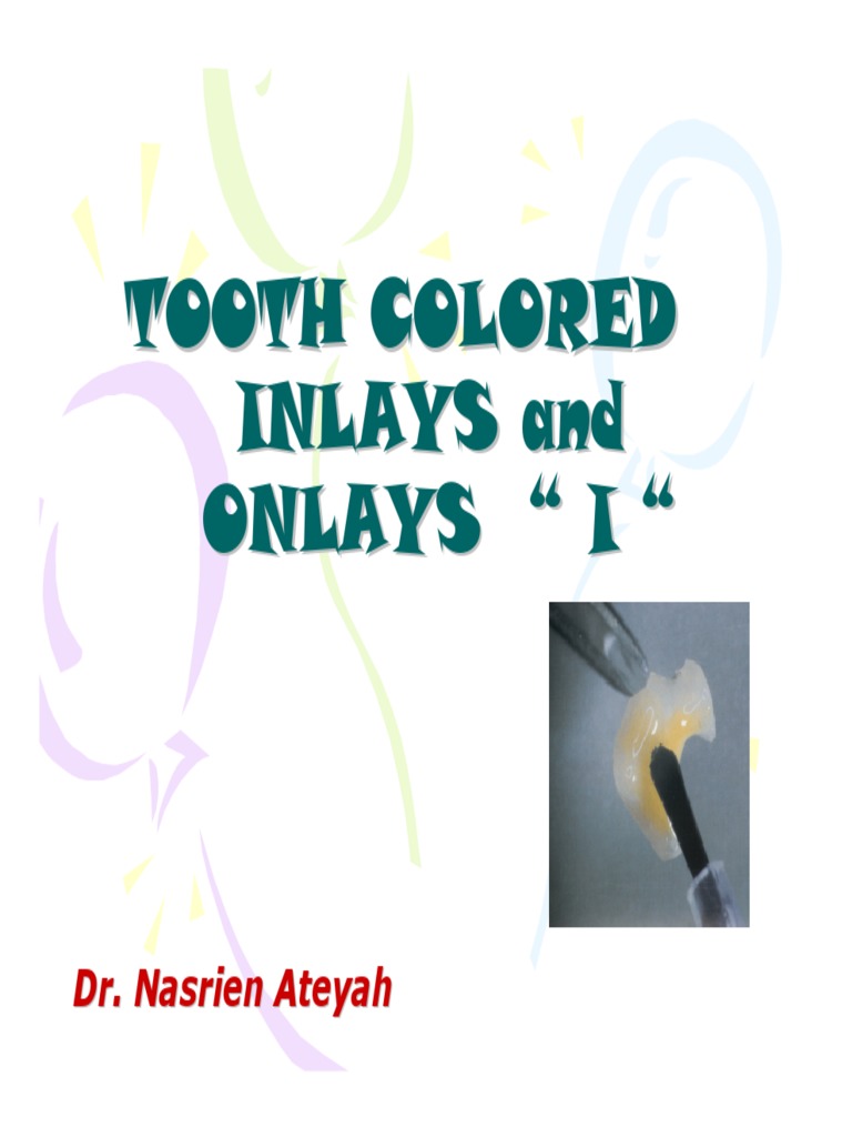 Microsoft Powerpoint - Tooth Colored Inlays and Onlays - I | PDF ...