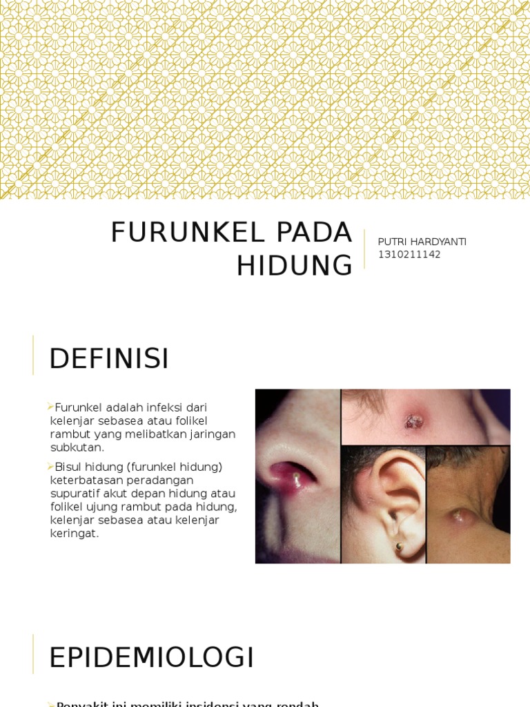 FURUNKEL HIDUNG