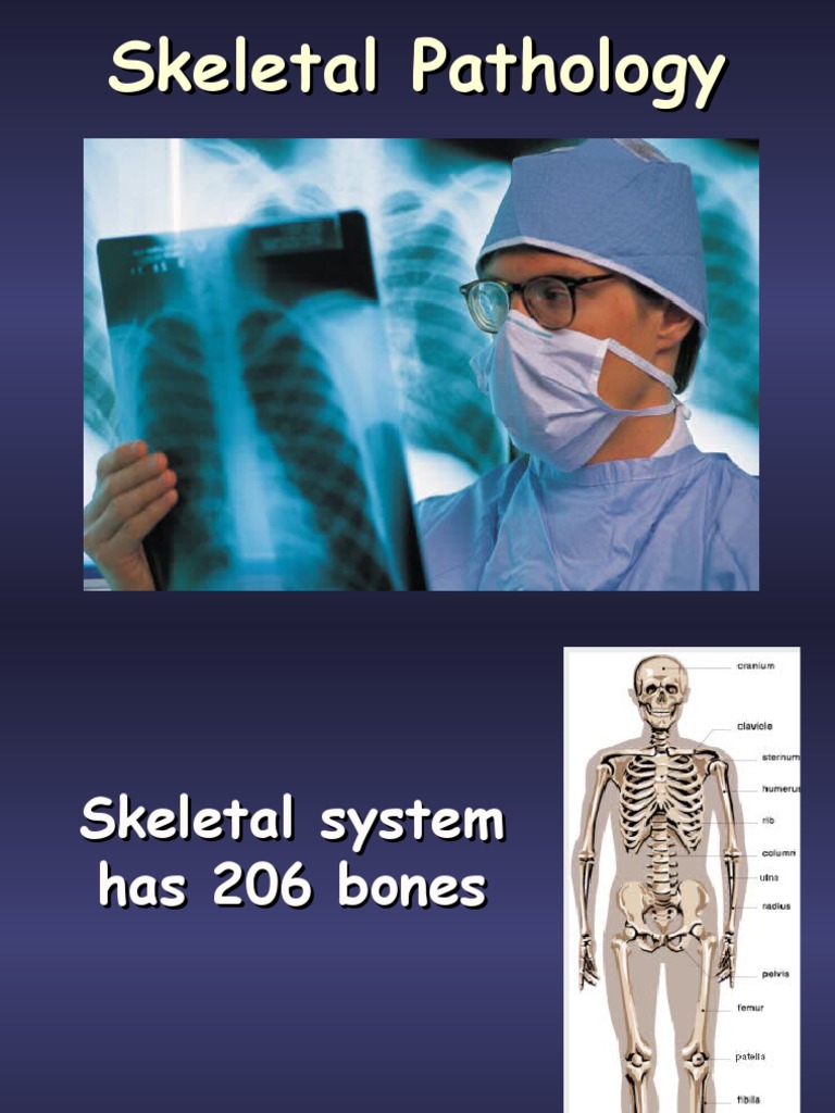 Skeletal Pathology | Joint | Vertebral Column