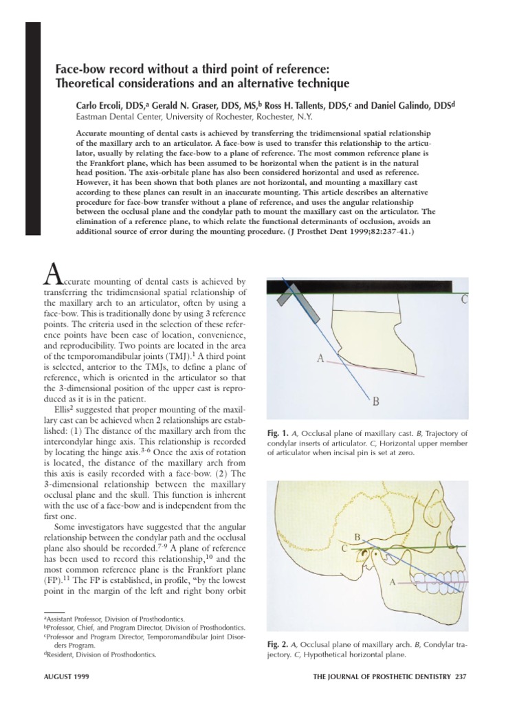 Face-bow Record Without a Third Point of Reference Theoretical ...