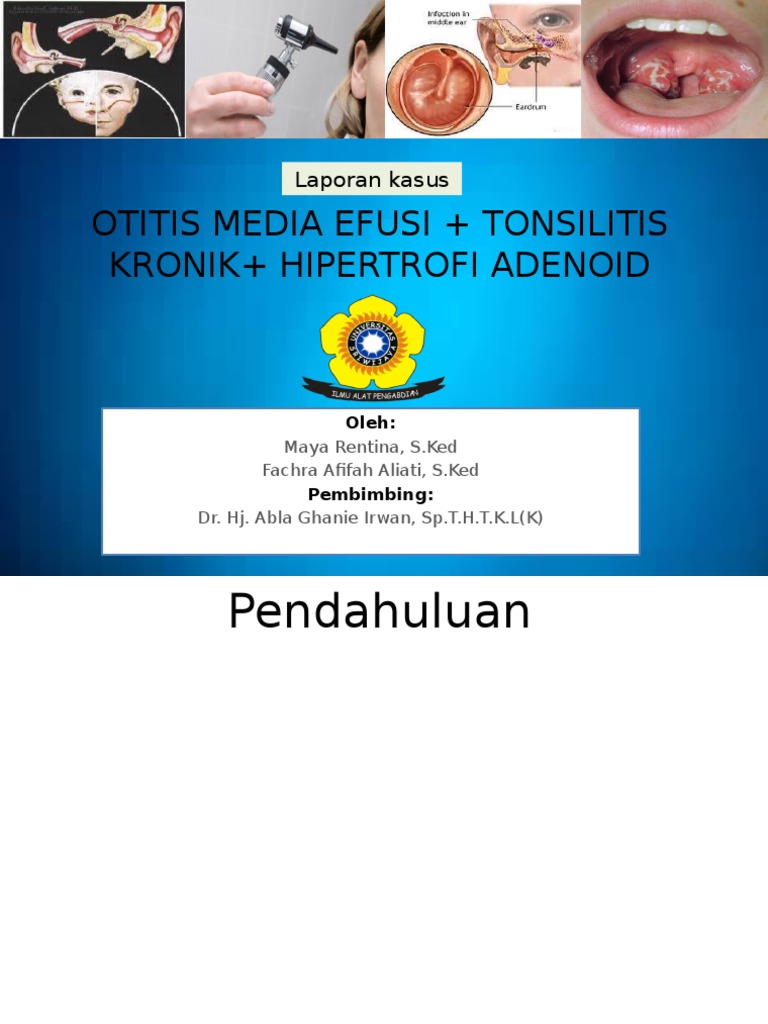 Otitis Media Efusi + Tonsilitis Kronik+ Hipertrofi | PDF