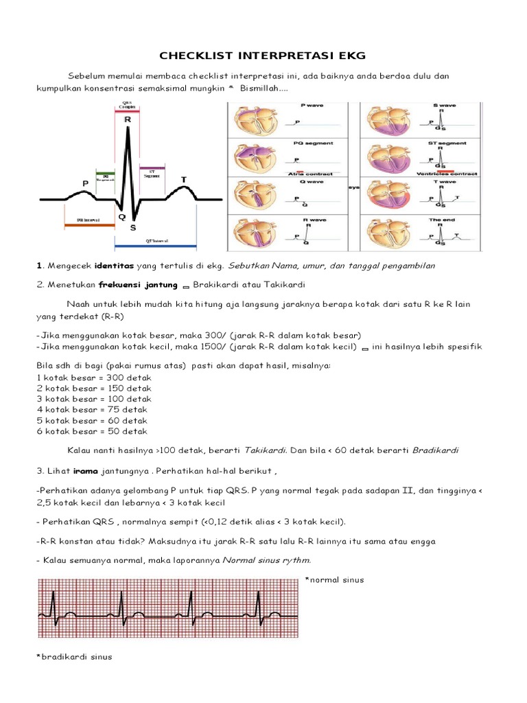 Checklist Interpretasi Ekg Revisi | PDF