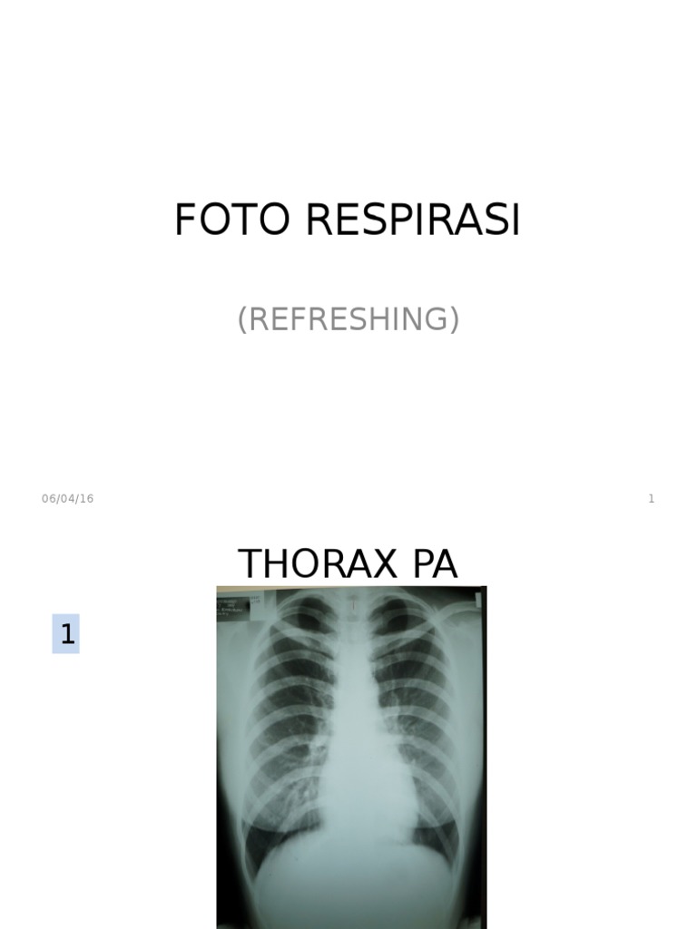 Gambaran Radiologi Penyakit Paru Berdasarkan Foto Thorax | PDF
