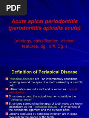 Acute Apical Periodontitis