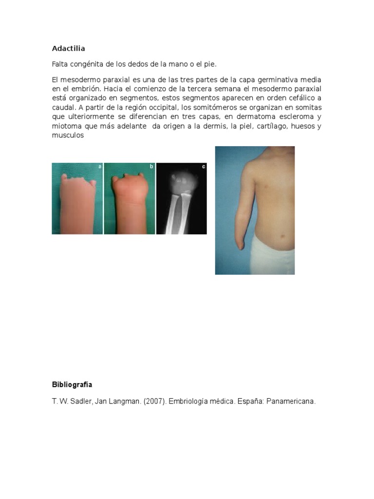 Adactilia | PDF