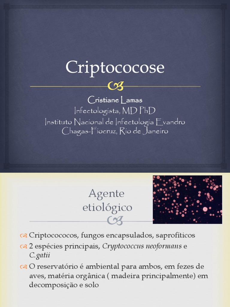 Criptococose Power Point PDF | PDF | Meningite | Líquido cefalorraquidiano