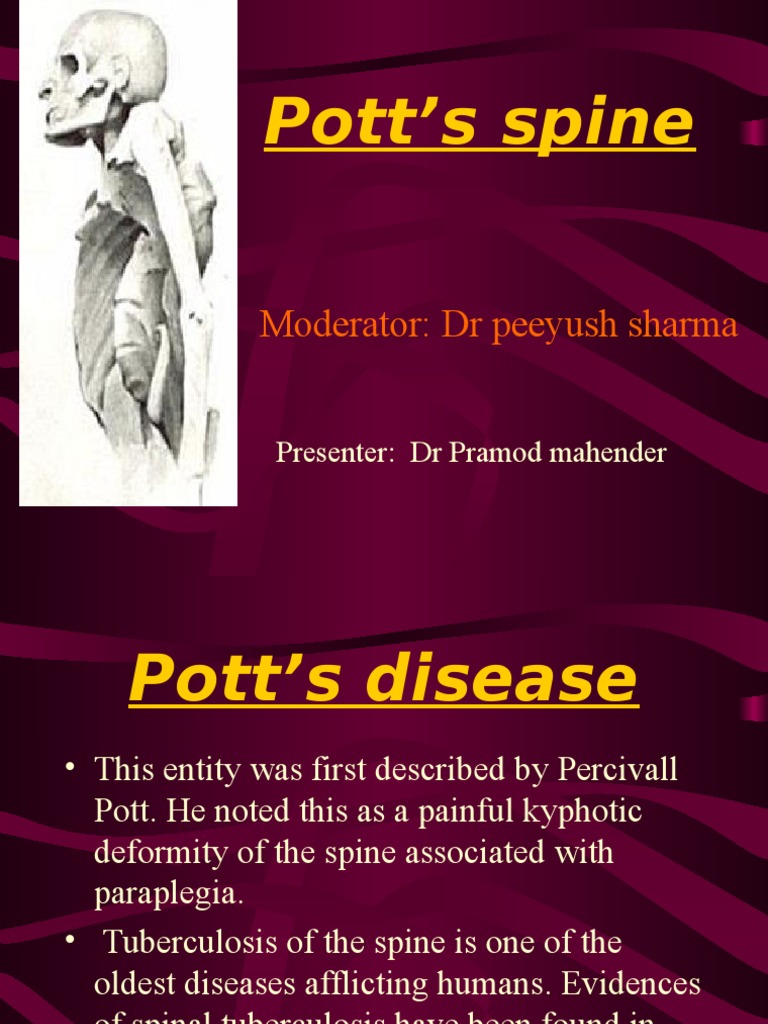 Pott Disease 1223292121651385 8 | PDF | Vertebral Column | Spinal Cord