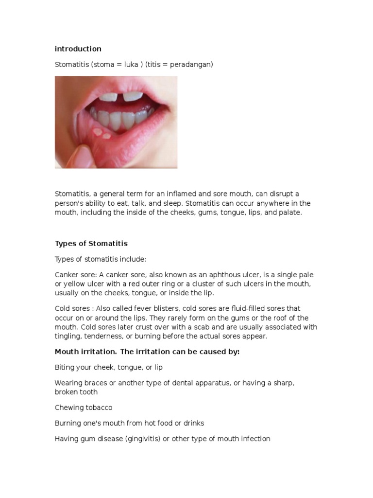 Stomatitis | PDF | Wellness | Lifestyle