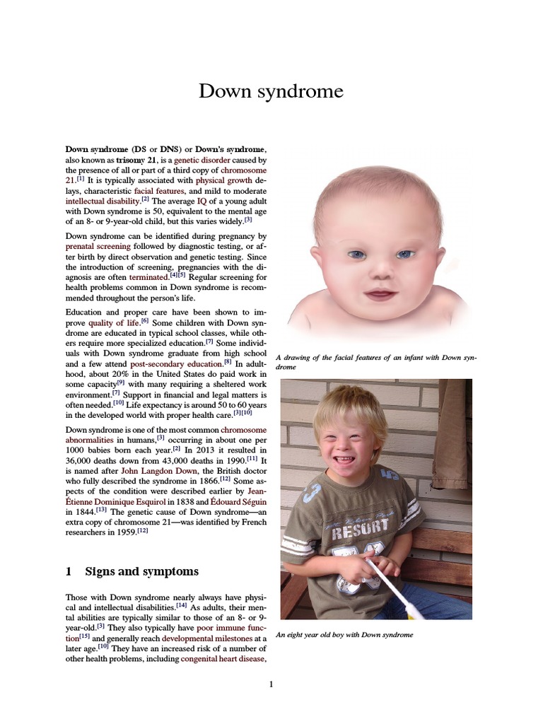 Down Syndrome | PDF | Down Syndrome | Health Sciences