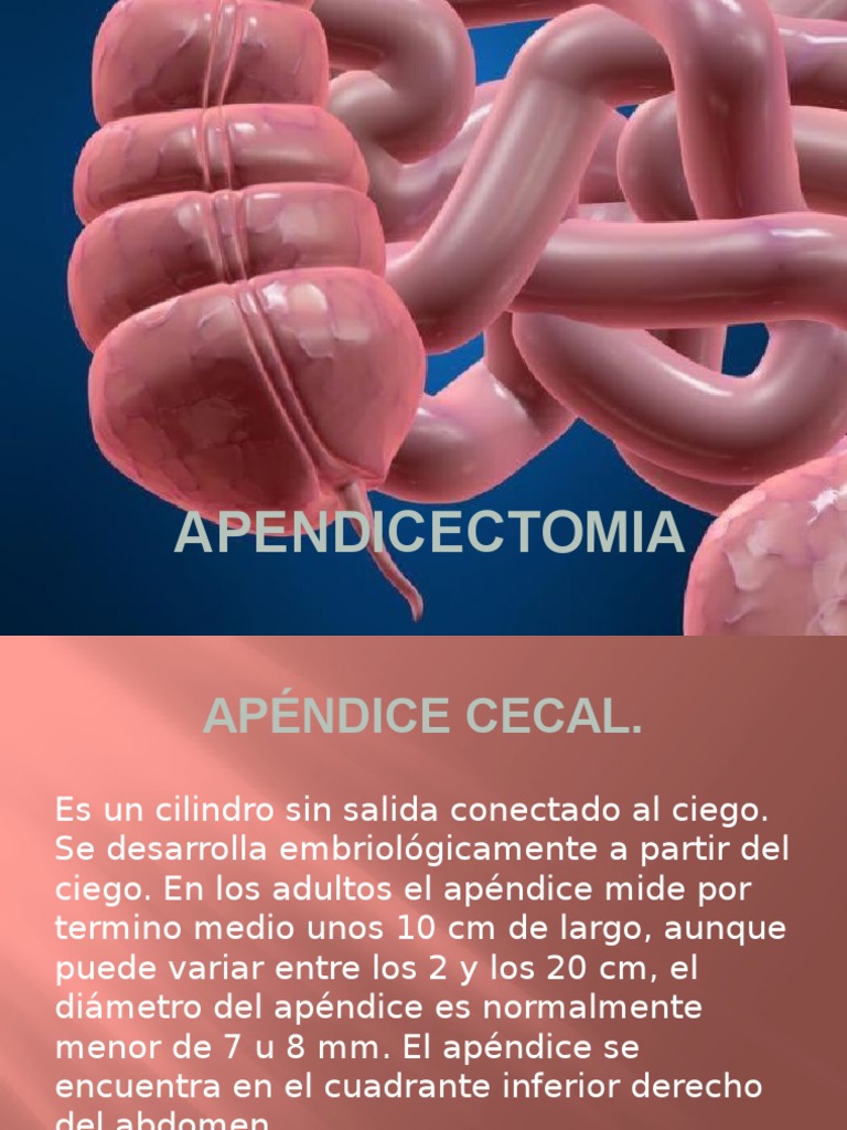 Apendicectomia | Especialidades Medicas | Gastroenterología