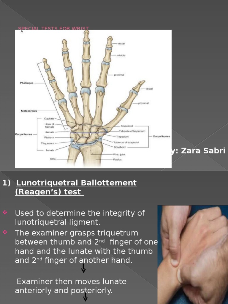 Special Tests For Wrist | PDF | Finger | Hand