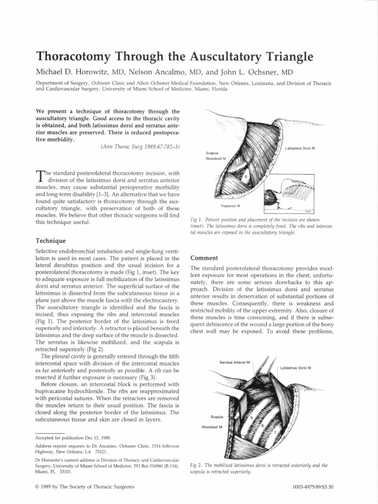 Thoracotomy Through the Auscultatory Triangle.ann Thorac Surg.1989 (1 ...