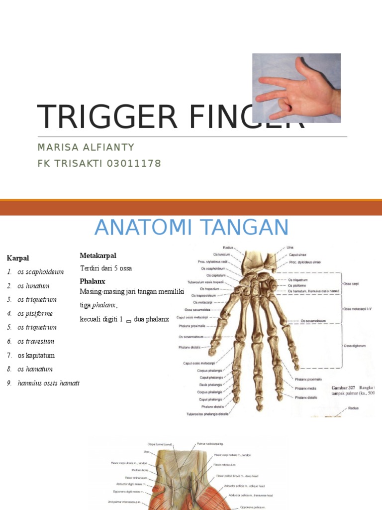 Trigger Finger | PDF