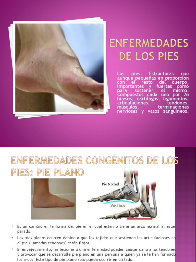 Enfermedades de los Pies | Pie | Clavo (anatomía)