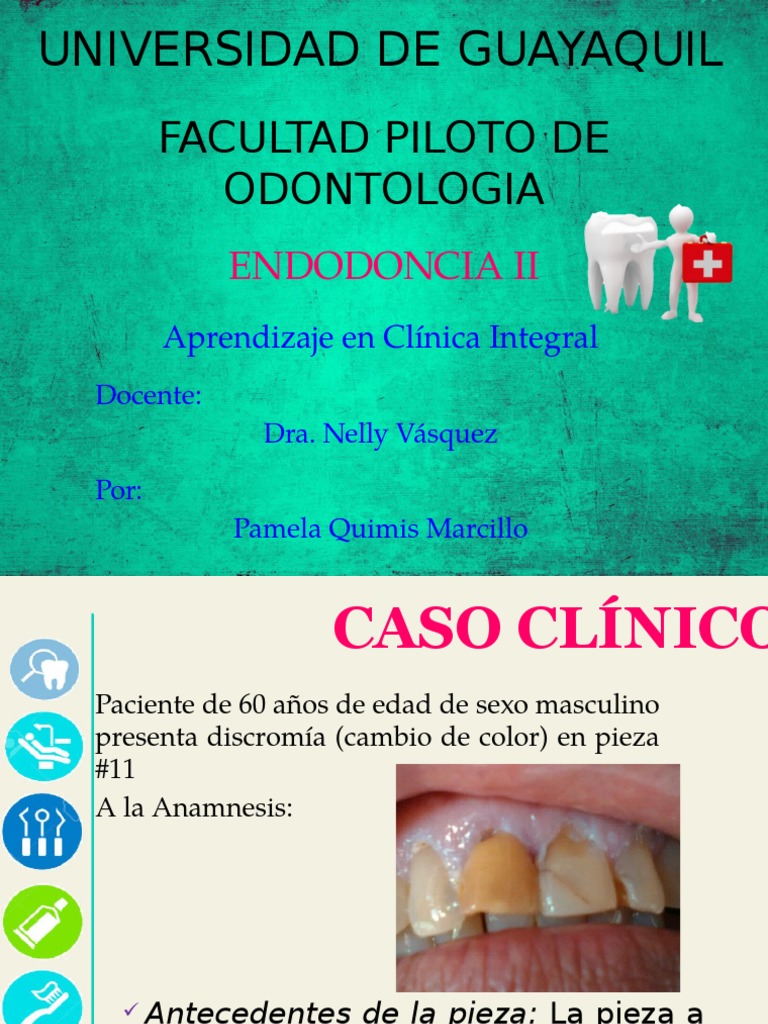Endodoncia - Obliteración Del Conducto | PDF