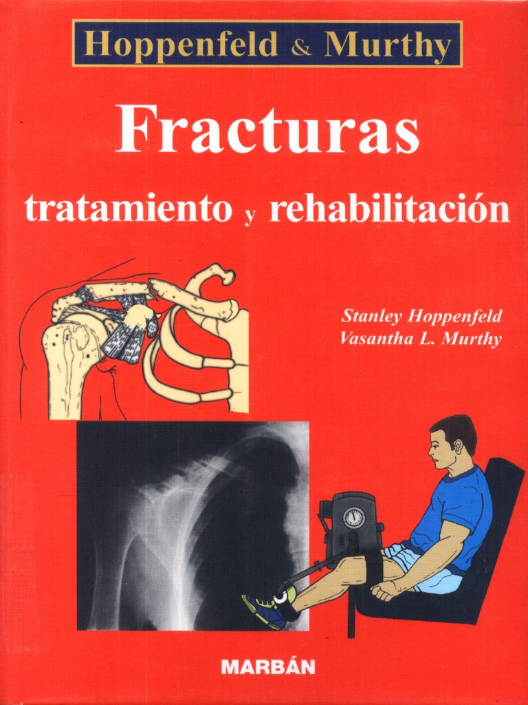 Hoppenfeld - Fracturas Tratamiento y Rehabilitación | PDF