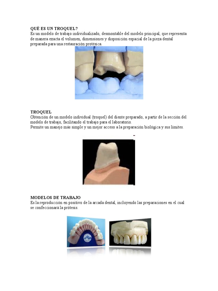Què Es Un Troquel | Dentadura postiza | Naturaleza