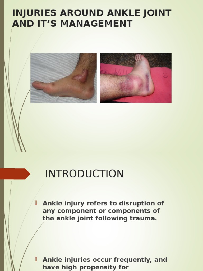 Ankle Injuries | Ankle | Musculoskeletal System
