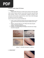 Perbedaan Erosi Dan Ekskoriasi | PDF