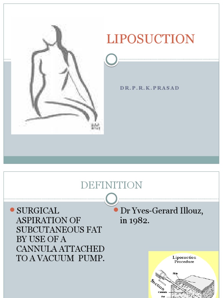 Liposuction | PDF | Adipose Tissue | Clinical Medicine