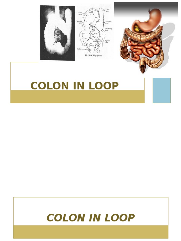Radiologi Colon in Loop | PDF | Sains & Matematika