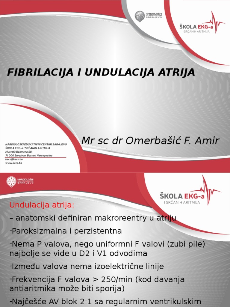 Undulacija I Fibrilacija Atrija Podloga | PDF