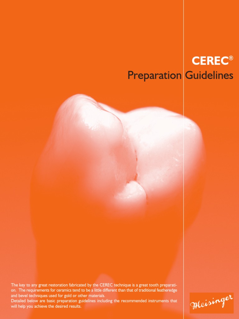 Cerec Prep Guide | PDF