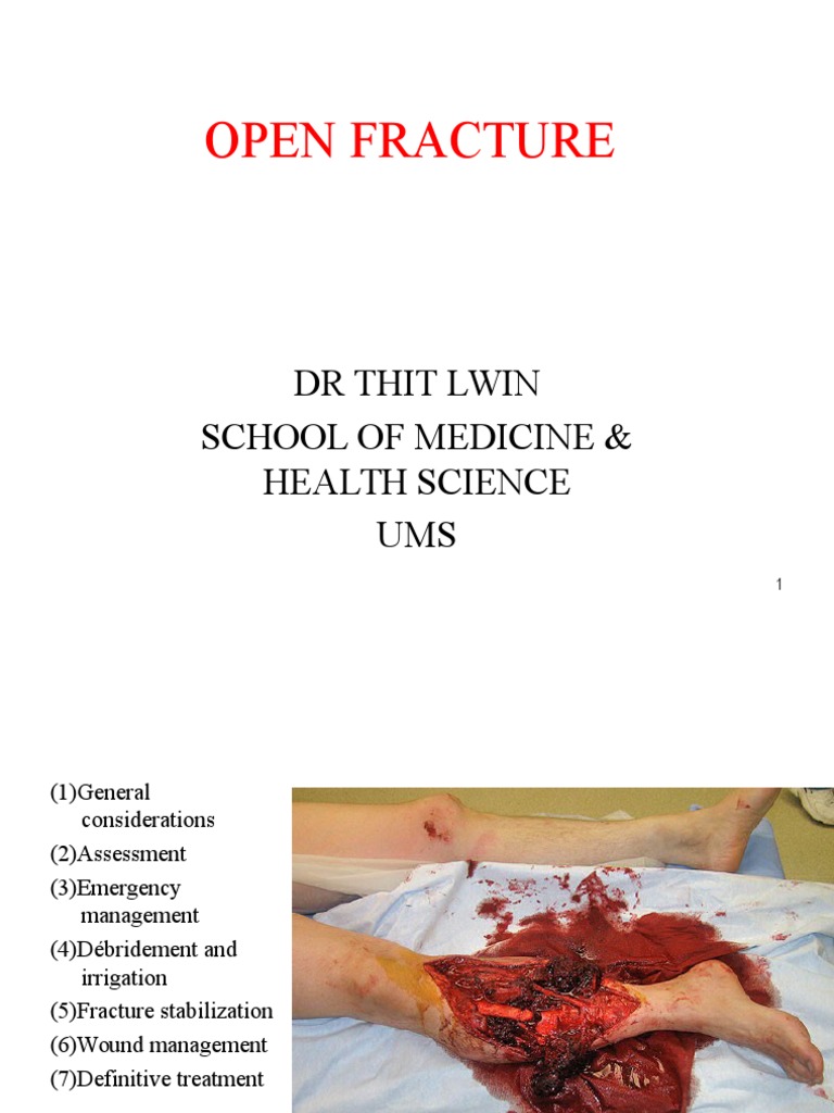 Comprehensive Guide to the Management of Open Tibial Fractures | PDF ...
