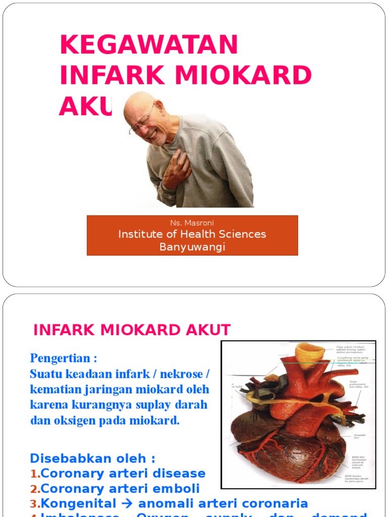 Akut Miokard Infark | PDF | Sains & Matematika