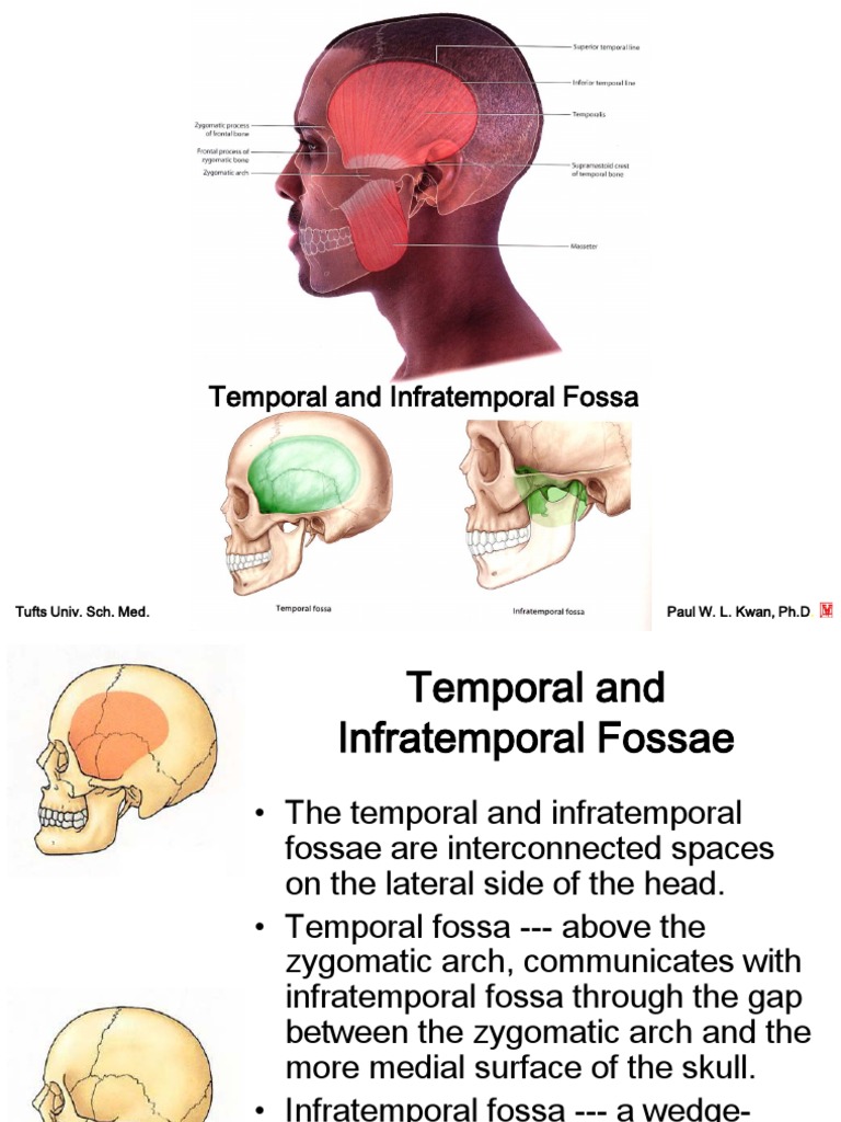 Temporal Fossa And Infratemporal Fossa